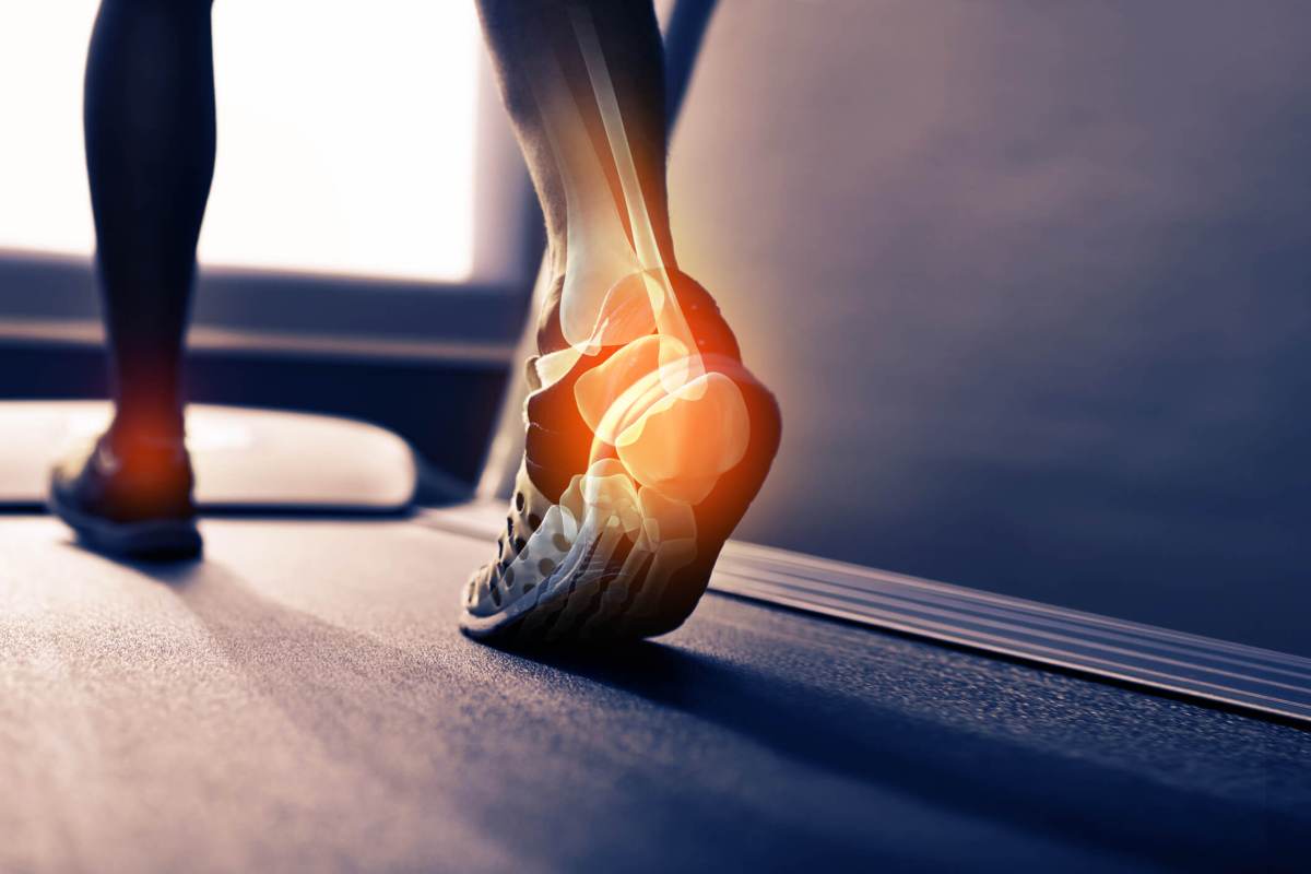 Hypermobility syndrome and Collagen Disorders – The Wessex Rheumatology ...